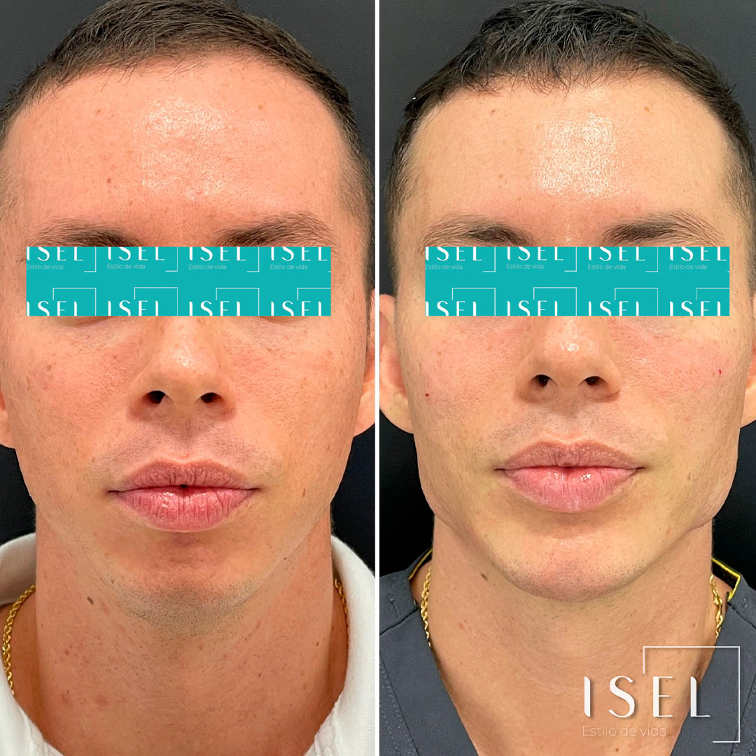 Resultados ISEL Estilo de Vida – ISEL Estilo De Vida