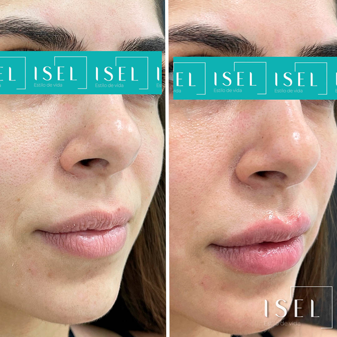 Resultados ISEL Estilo de Vida – ISEL Estilo De Vida