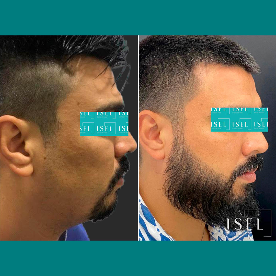 Resultados ISEL Estilo de Vida – ISEL Estilo De Vida