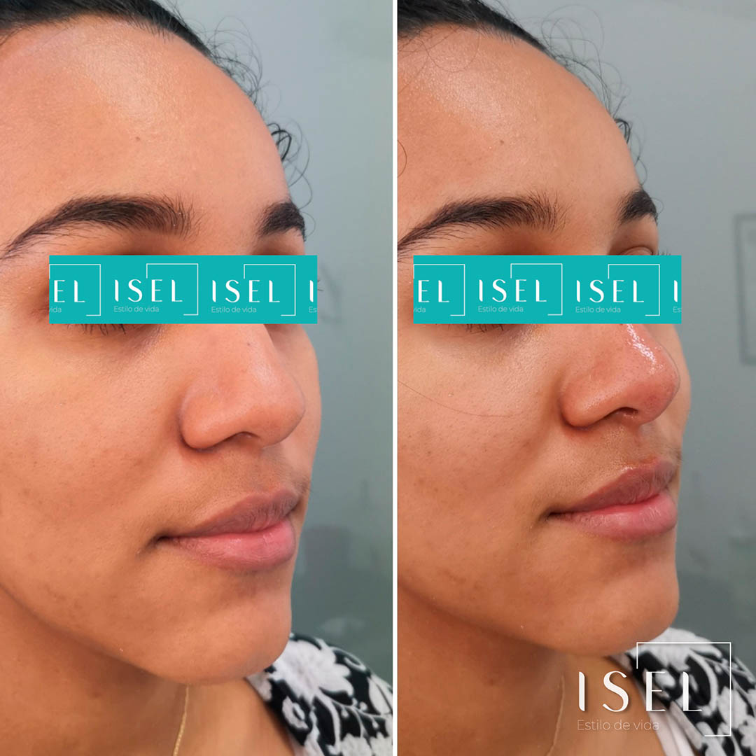 Resultados ISEL Estilo de Vida – ISEL Estilo De Vida